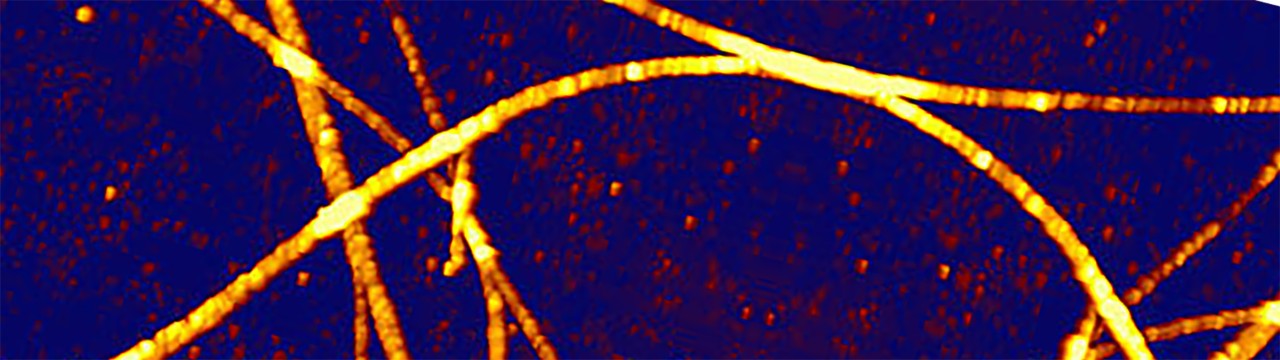 BioAFM Applications Gallery: AFM/OT and Advanced Optics | Bruker