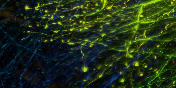 Cleared Sample Imaging by Means of Light-Sheet Fluorescence Microscopy ...