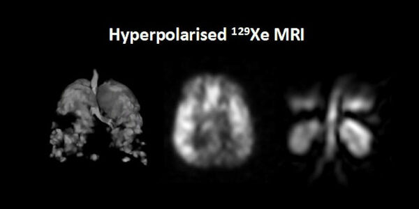 Clinical Methods and Applications of Hyperpolarized 129Xe MRI for ...