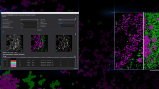 Single-Molecule Localization Microscopy: Beyond the Coverslip | Bruker