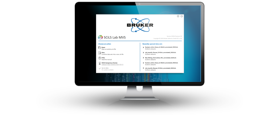 SCiLS Lab | Bruker