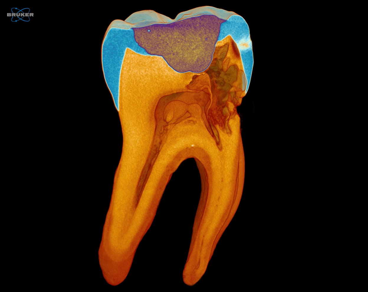 High Capacity 3D X-ray Microscopy | Solutions | Bruker