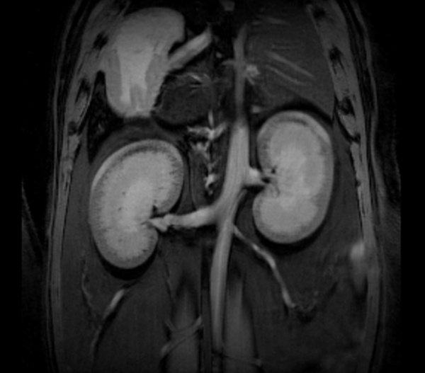 MRI RF Coils | RF Coil Technical Details | Bruker