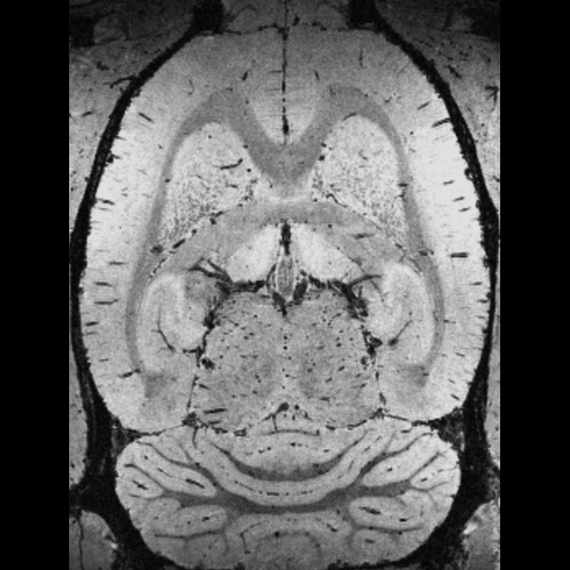 MRI RF Coils | RF Coil Technical Details | Bruker