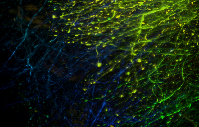 Cleared Sample Imaging by Means of Light-Sheet Fluorescence Microscopy ...