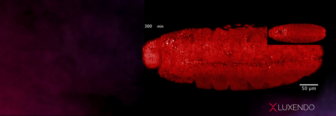 Seeing Life from a Different Angle using Bioimaging with Light-sheet ...