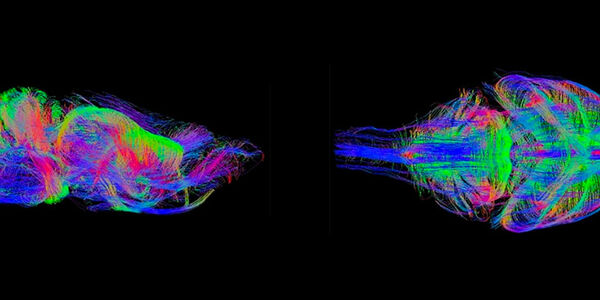 Diffusion MR: Basics and Applications | Bruker