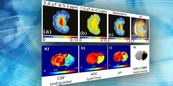 Introduction to CEST for MRI Assessment of Brain Ischemia and Cancer ...