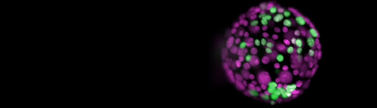 Imaging Breast Cancer Evolution in 3D Organoid Cultures | Bruker