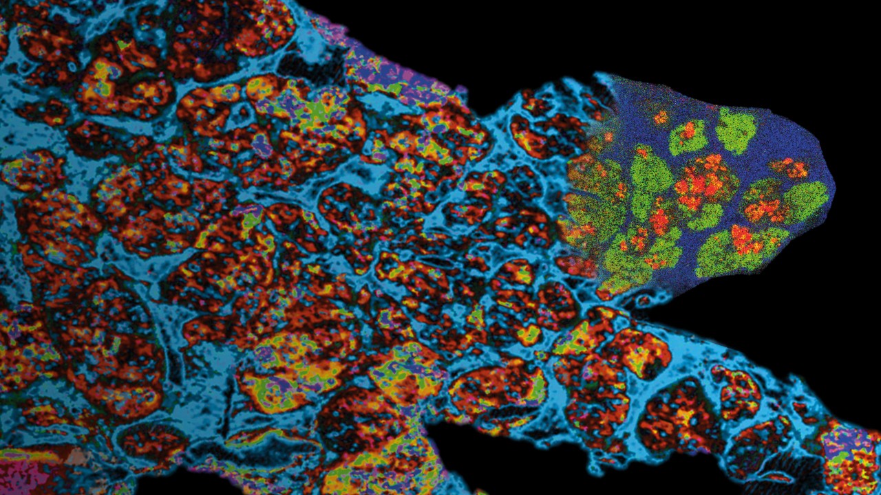 MALDI Imaging with IR Laser Imaging | Bruker