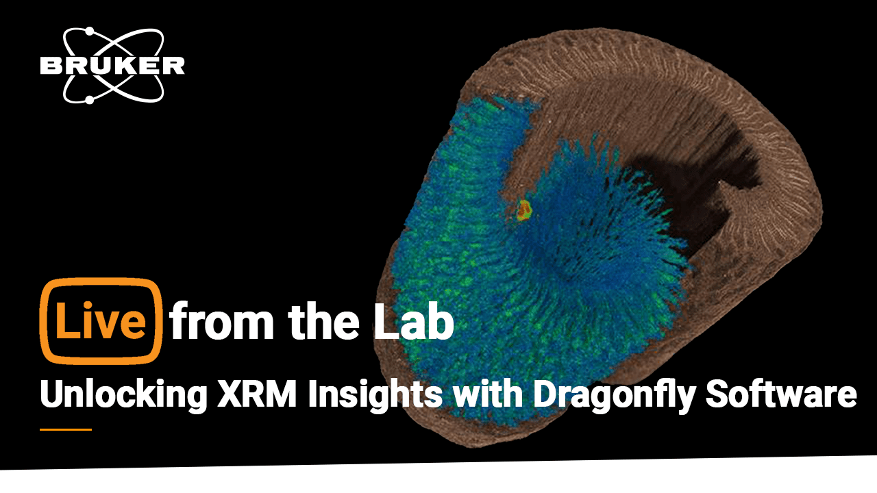 S5 E2: Unlocking XRM Insights with Dragonfly Software | Bruker