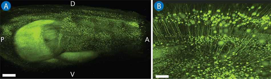 Considerations for Cleared Tissue Imaging with Light-Sheet Fluorescence ...