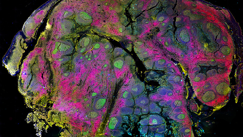 Spatial-Omics Solutions | Bruker