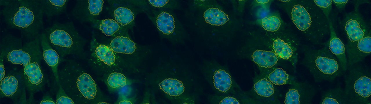 RNA Visualization and Quantification with Single Molecule FISH (smFISH ...