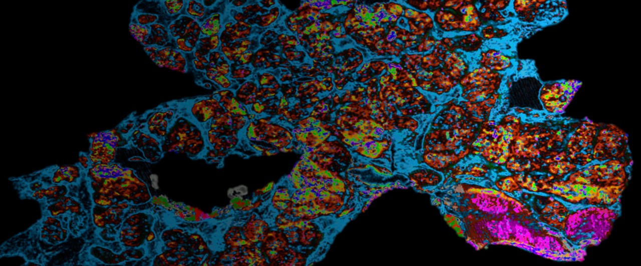 IR Guided MALDI Imaging | Bruker
