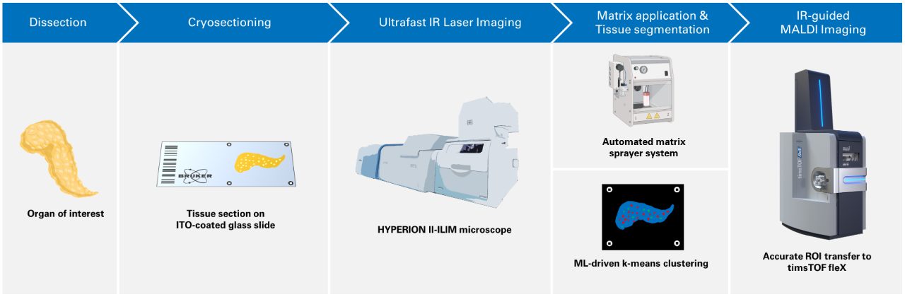IR Guided MALDI Imaging | Bruker