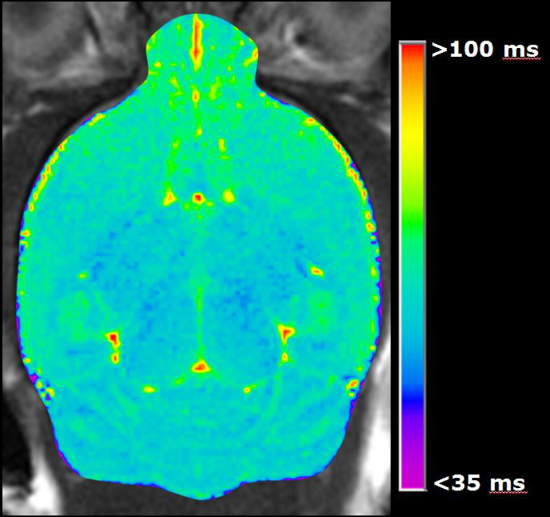 MRI RF Coils Technical Details | Bruker