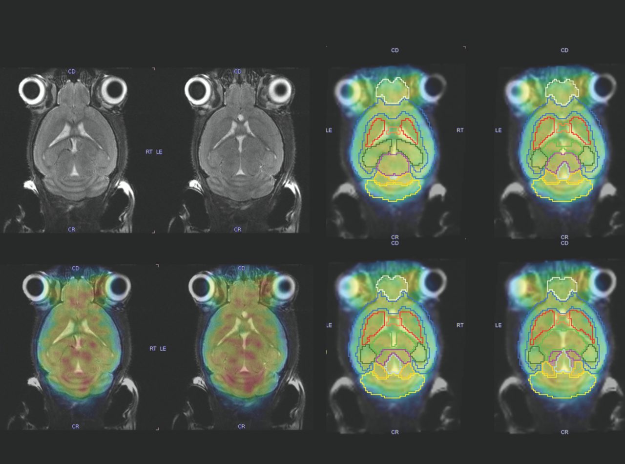 PET Insert | Positron Emission Tomography | Bruker