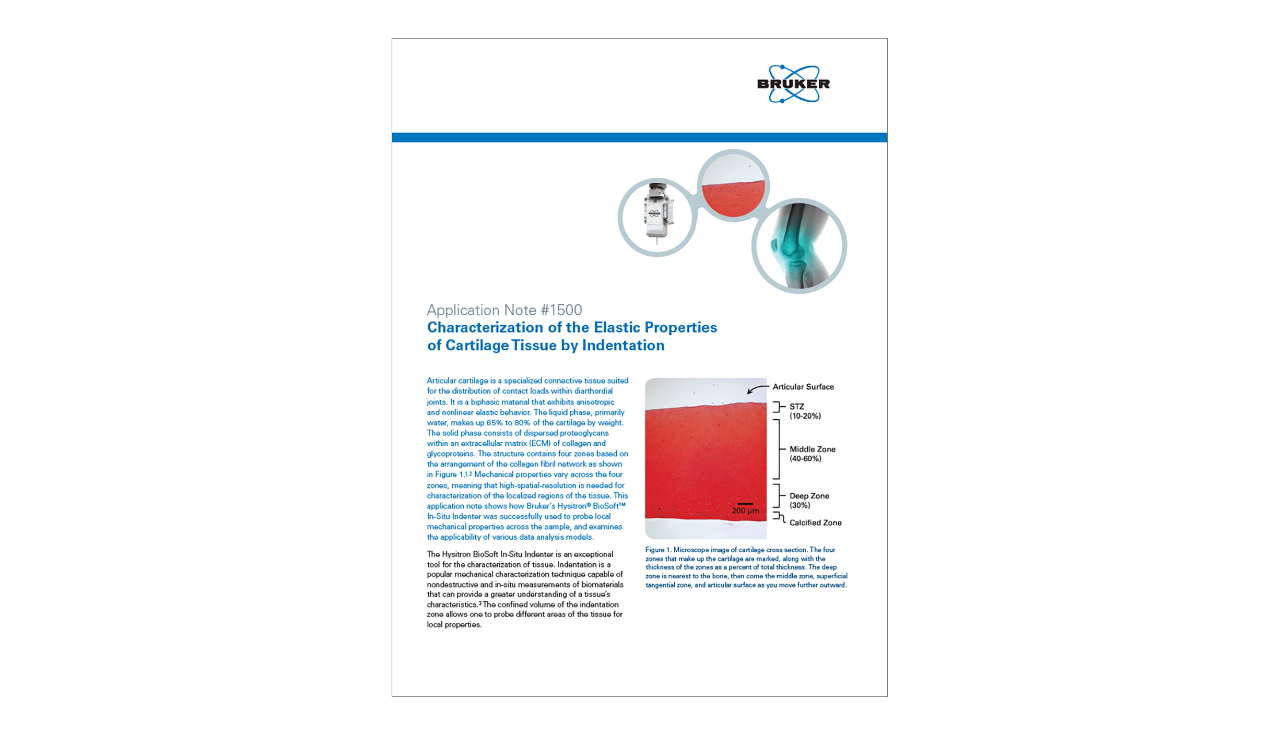 Characterization of the Elastic Properties of Cartilage Tissue by ...