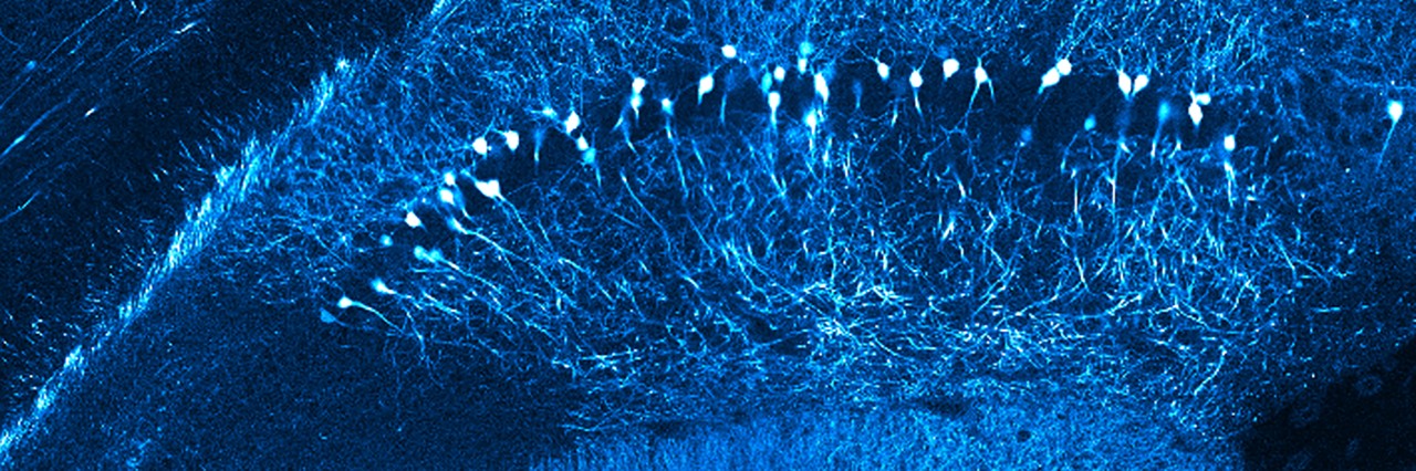 Advances in Multiphoton Imaging and SLM Holographic Stimulation | Bruker