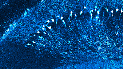 Advances in Multiphoton Imaging and SLM Holographic Stimulation | Bruker