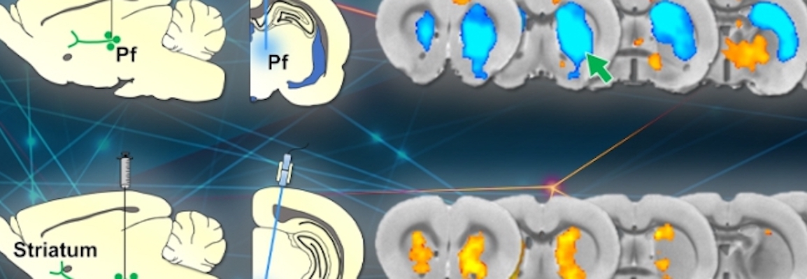 Stimulating and Recording Neuronal Activity During Traditional fMRI ...