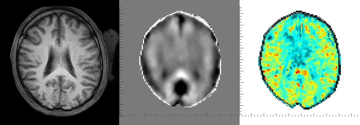 Magnetic Resonance Elastography | Preclinical Applications | Bruker