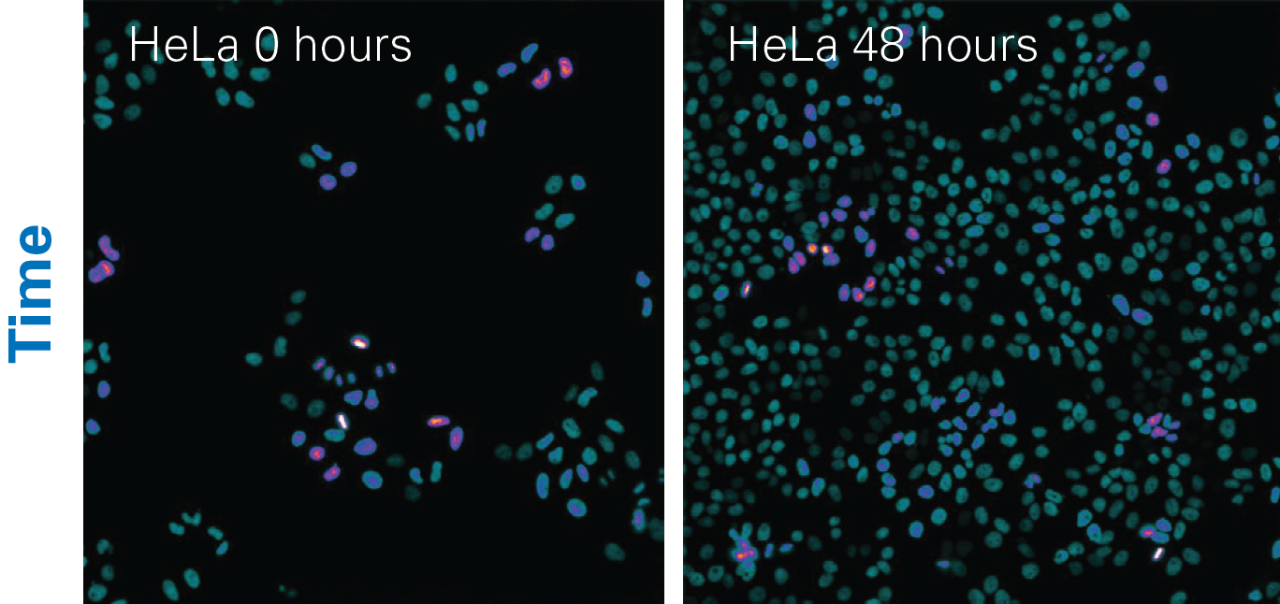 Acquifer IM | Bruker