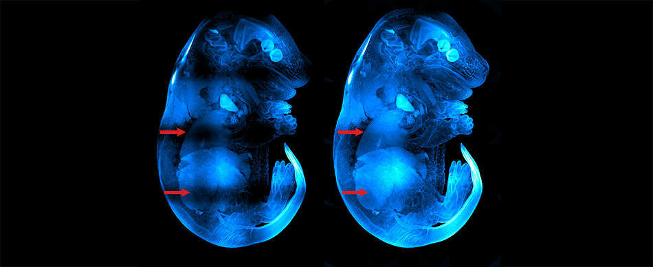 Flatfield Correction In Light Sheet Fluorescence Microscopy Bruker