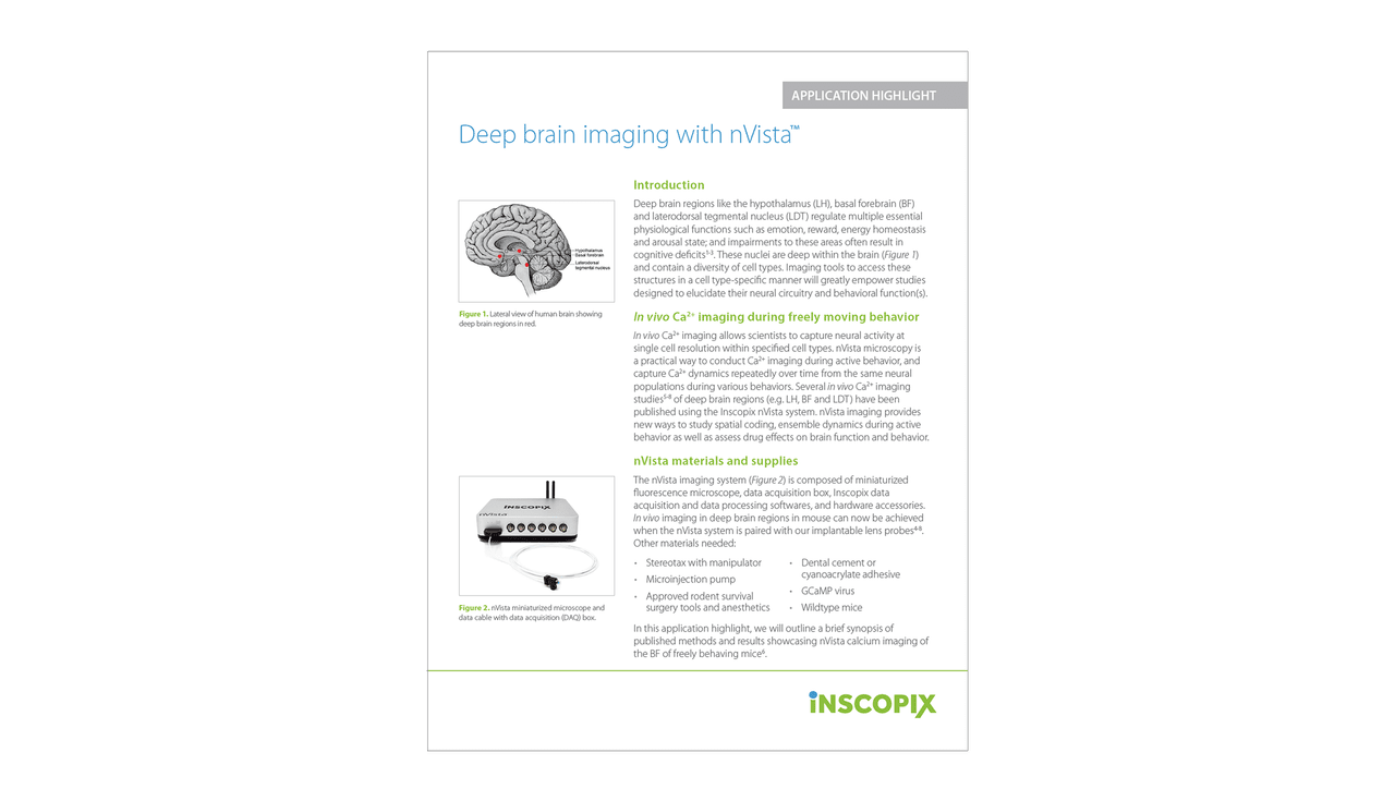 Application Note: Deep Brain Imaging with nVista™ | Bruker