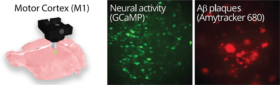 Case Study: Disease Model Phenotyping and Efficacy Assessment for ...