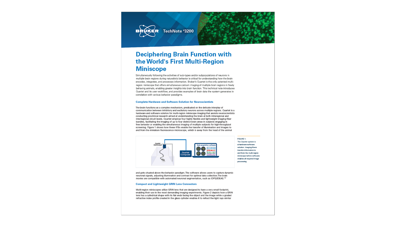 Tech Note: Deciphering Brain Function with the World's First Multi ...