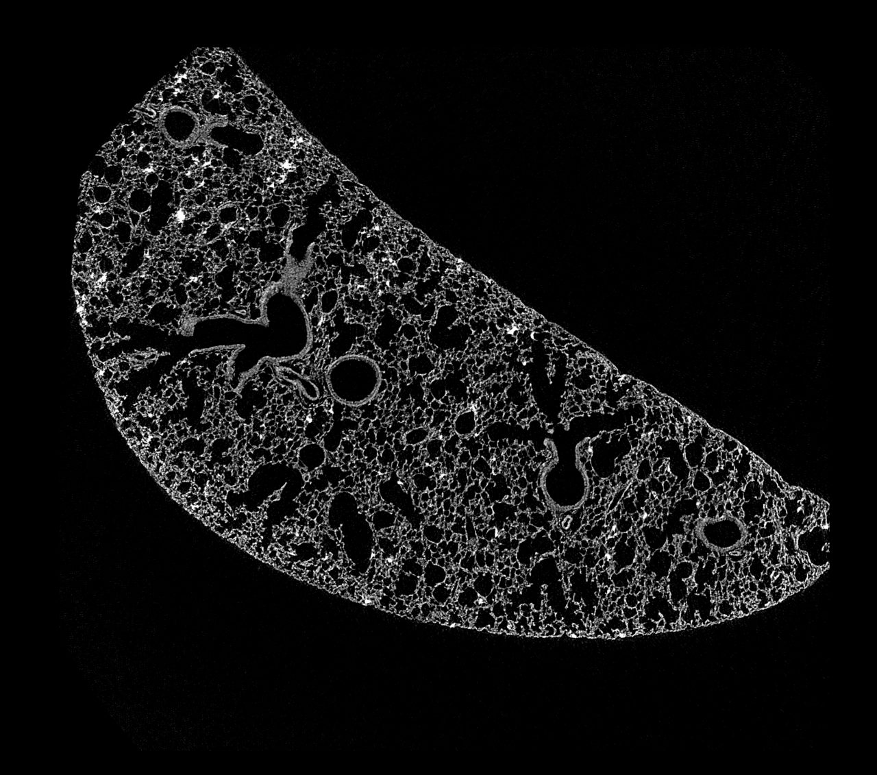 High Resolution 3D X-ray Microscopy | Solutions | SKYSCAN 1272 | Bruker