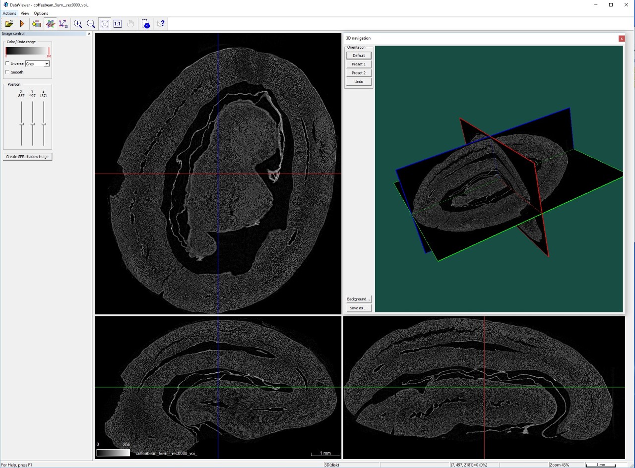High Resolution 3D X-ray Microscopy | Solutions | Bruker