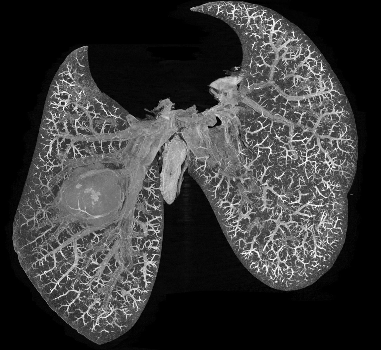 High Resolution 3D X-ray Microscopy | Solutions | Bruker