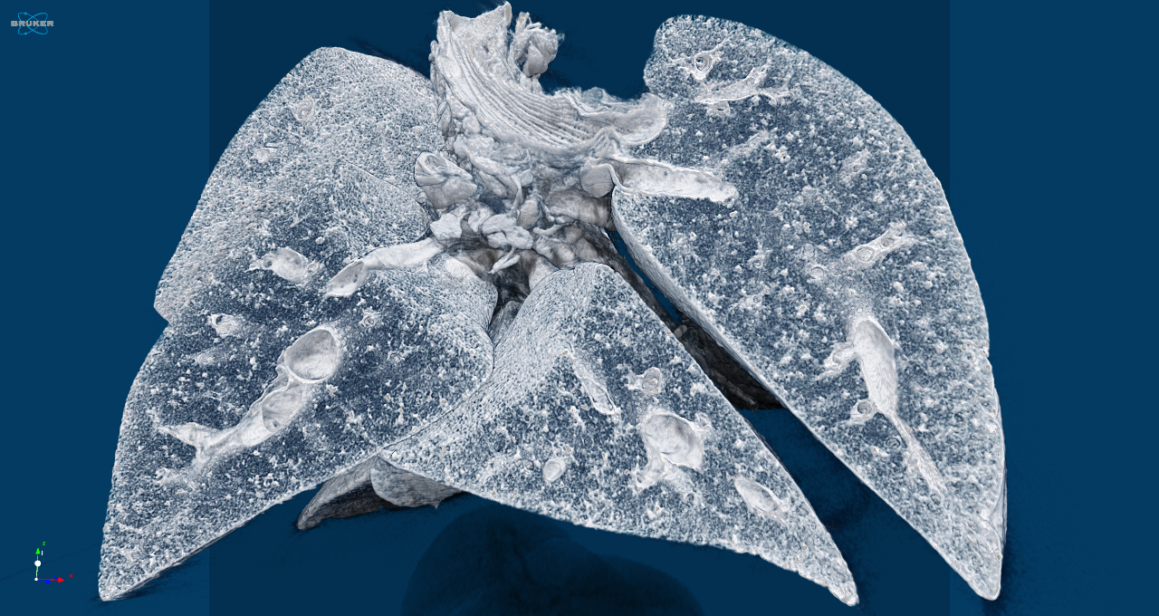 High Resolution 3D X-ray Microscopy | Solutions | SKYSCAN 1272 | Bruker