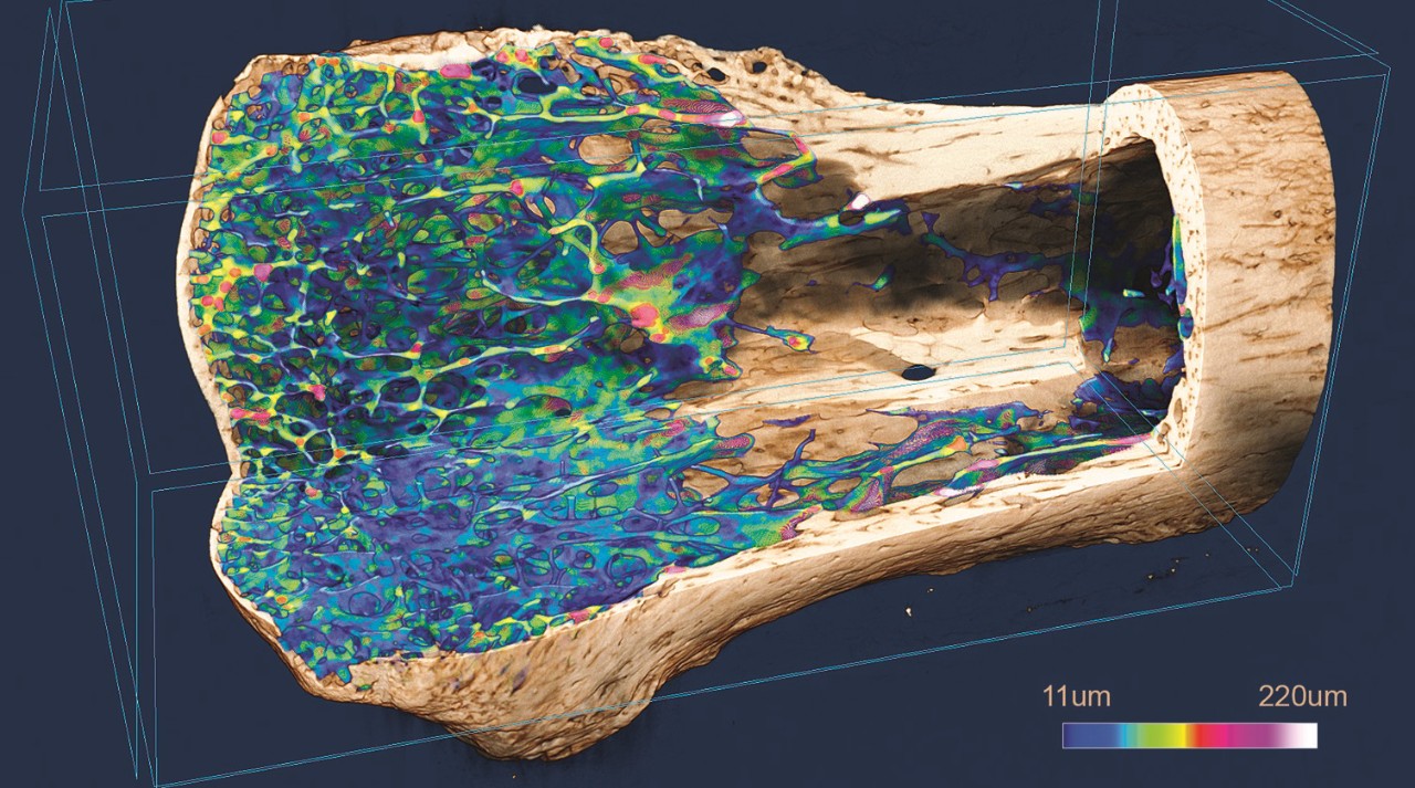 High Capacity 3D X-ray Microscopy | Solutions | Bruker