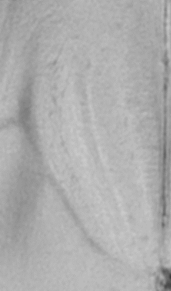 Ultra-High-Field MRI | Mouse Imaging | Bruker