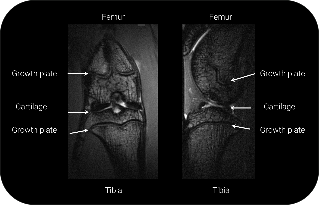 MRI RF Coils | RF Coil Technical Details | Bruker