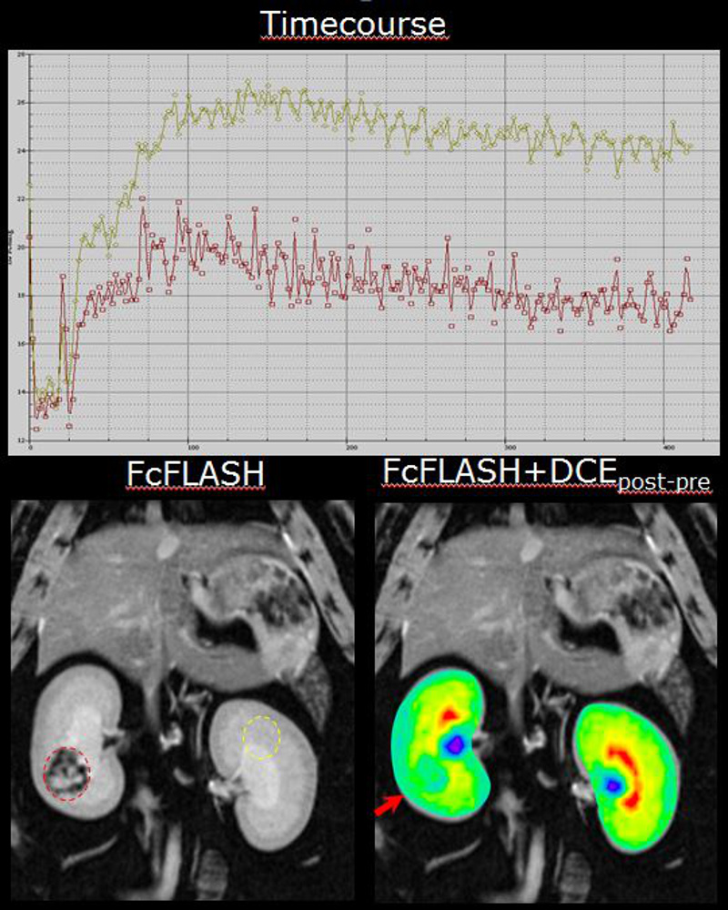 MRI RF Coils | RF Coil Technical Details | Bruker