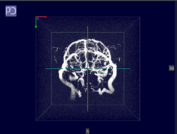 MRI RF Coils | RF Coil Technical Details | Bruker
