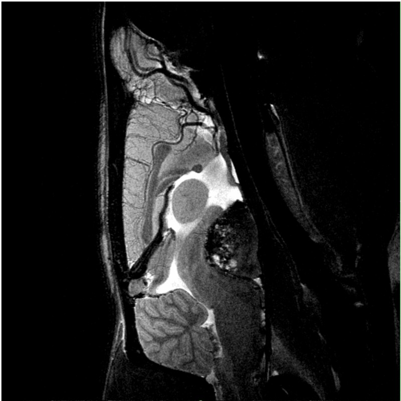 PharmaScan | MRI Ultra-shielded Technology | Bruker