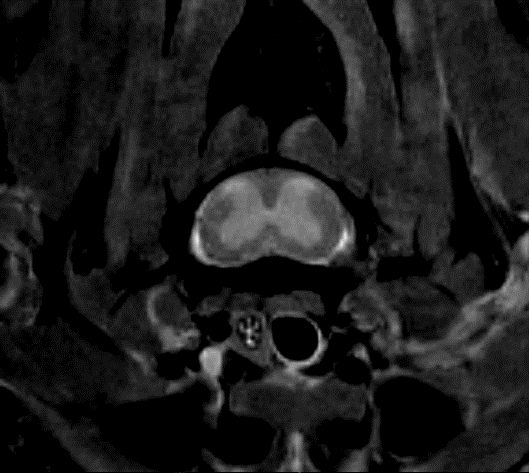 PharmaScan | MRI Ultra-shielded Technology | Bruker