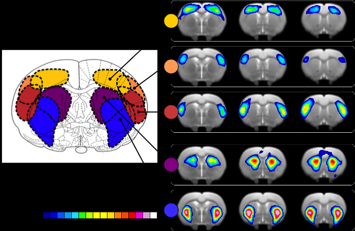 Ultra-High Field MRI | UHF MRI System | Manufacturer | Bruker