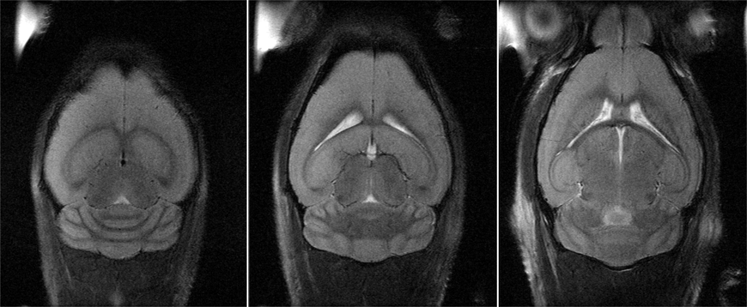 Ultra-High Field MRI | UHF MRI System | Manufacturer | Bruker