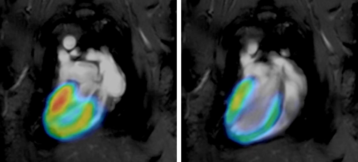 PET Insert | Positron Emission Tomography | Bruker