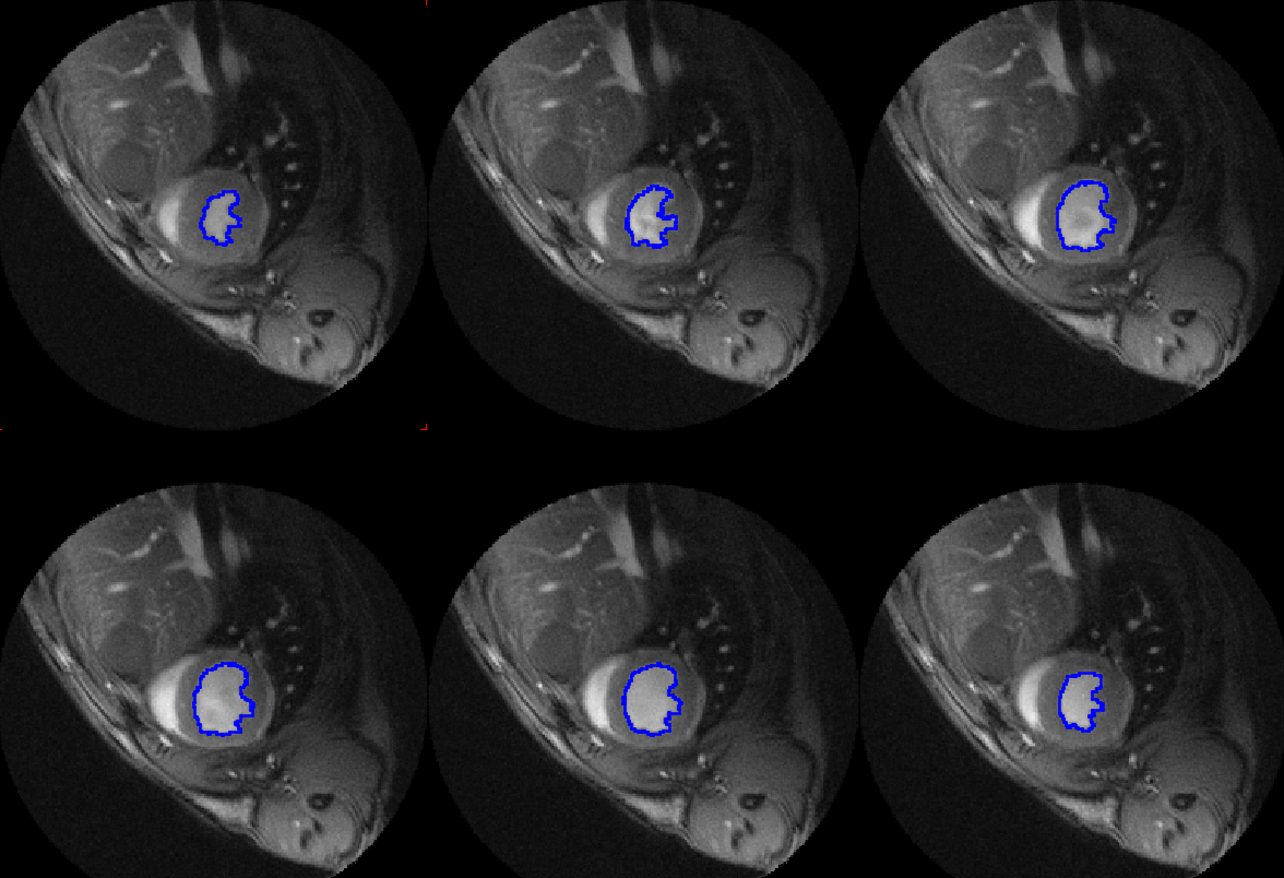 PMOD Select | Bruker