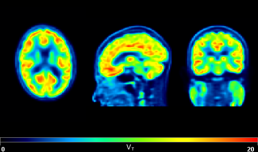PMOD Select | Bruker