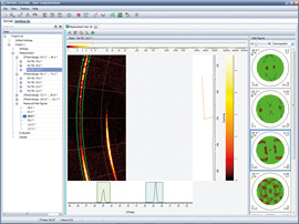 EIGER2 R detectors | Bruker