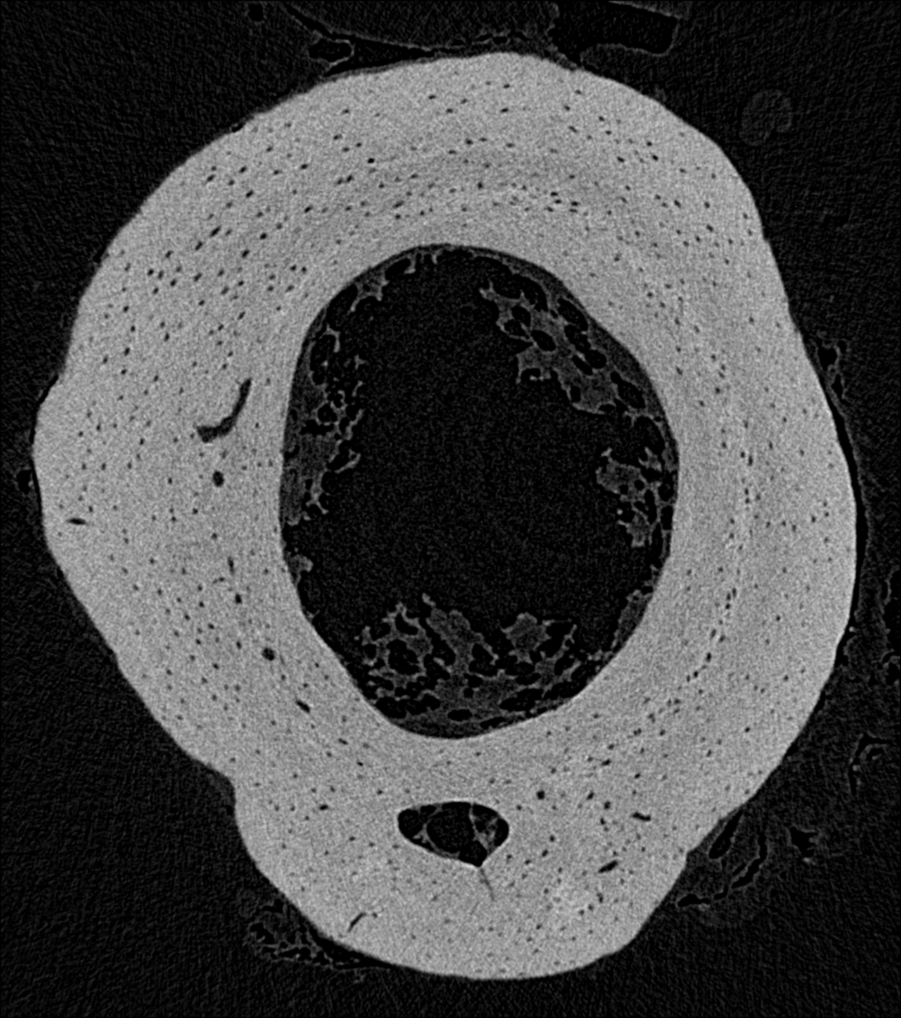 High Resolution 3D X-ray Microscopy | Solutions | SKYSCAN 1272 | Bruker